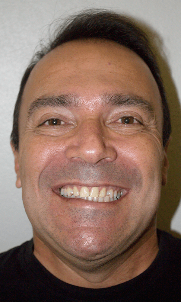Dr José Bruno Conquiste O Sorriso Dos Seus Sonhos